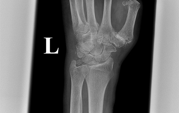 Woman with pain, swelling, and warmth in wrist - Journal of Urgent Care ...