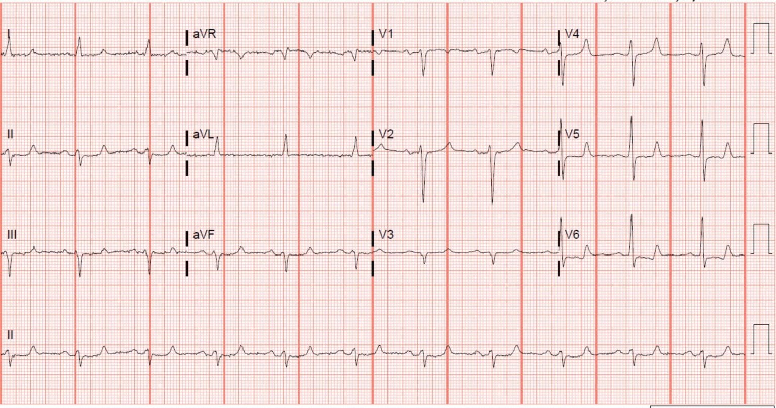 A 50-Year-Old Male with Several Chronic Conditions and Foot Pain at an ...