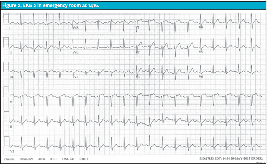 When Is Tachycardia in a Patient with URI Symptoms a Sign of Something ...