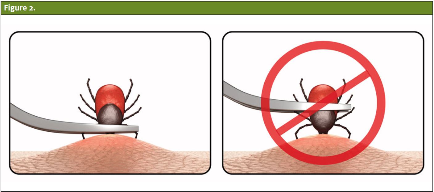 A New-Onset, Suspicious Skin Lesion - Journal of Urgent Care Medicine