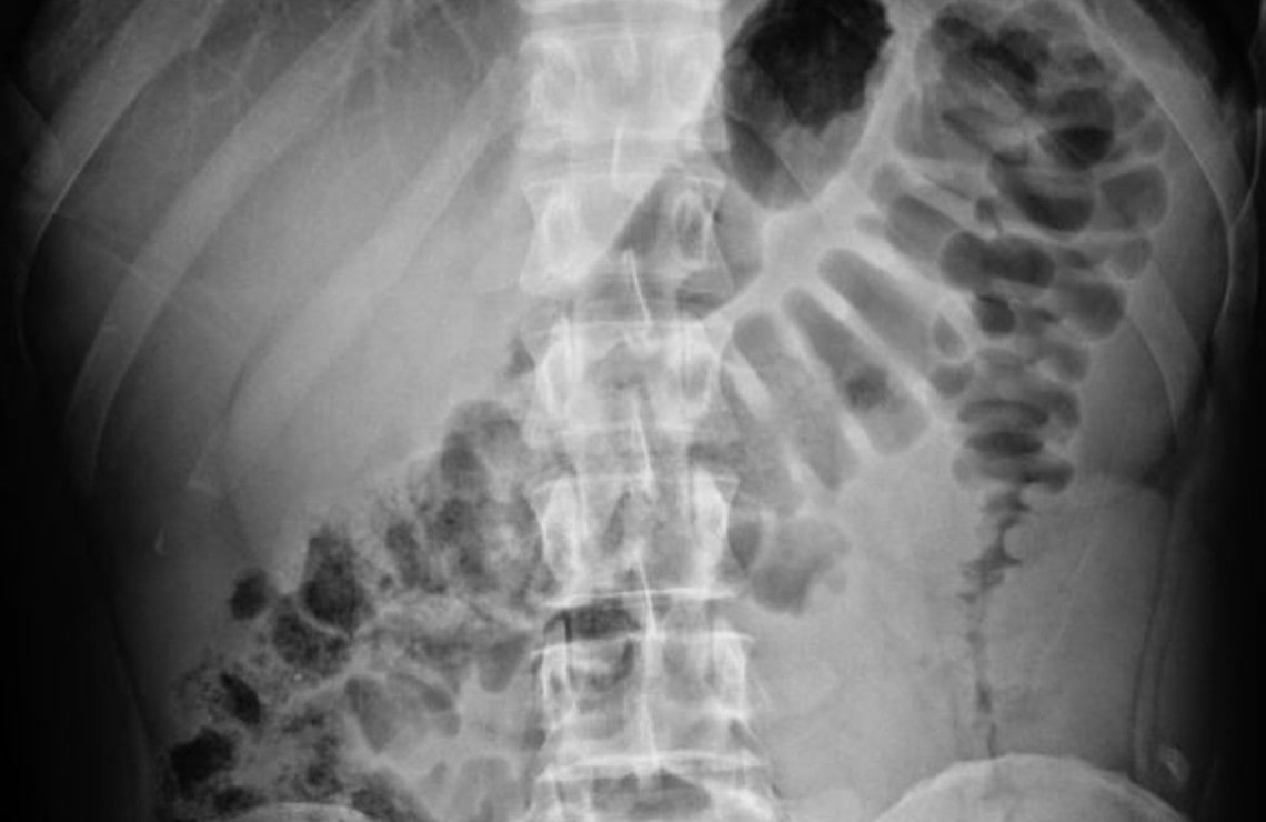 A 28-Year-Old Man with Diarrhea and Abdominal Pain - Journal of Urgent ...