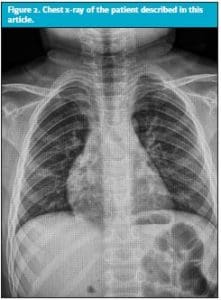 Evaluation of Nonfatal Drowning in Urgent Care - Journal of Urgent Care ...