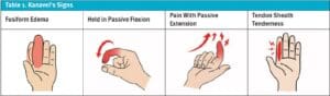 High-Pressure Paint Gun Finger Injury: A Case Report - Journal of ...